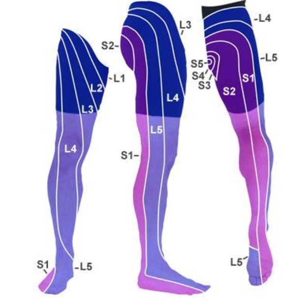 Human Dermatomes - backpaininfo.org